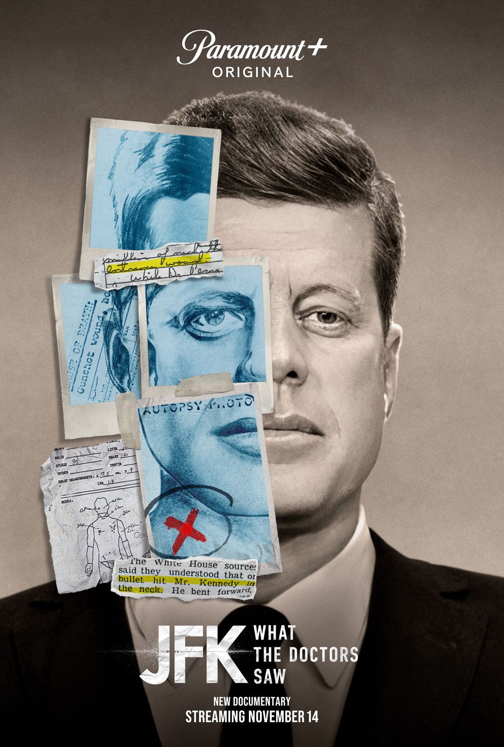 JFK: What The Doctors Saw - Film documentaire 2023 - AlloCiné